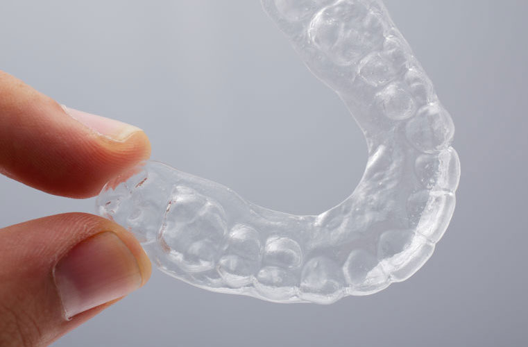 What kind of retainers are there? - Parkside Orthodontics